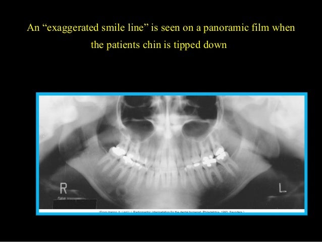 Lecture 6 panoramic radiograph