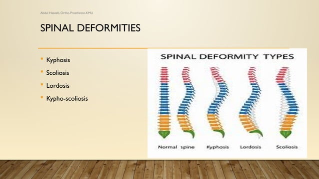 lecture#6 Spinal deformities & it orthotic Prescriptions.pptx