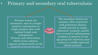 Tuberculosis of the oral cavity and facial bones (orofacial ...