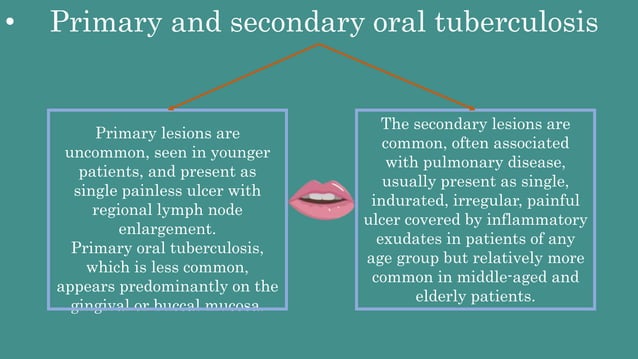 Tuberculosis of the oral cavity and facial bones (orofacial ...