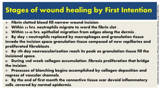 Lecture 6 tissue repair healing and regeneration | PPTX