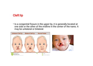 lecture 7-child with GIT disorders (1).pdf
