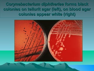 Lecture 7 Corynebacterium and listeria | PPT