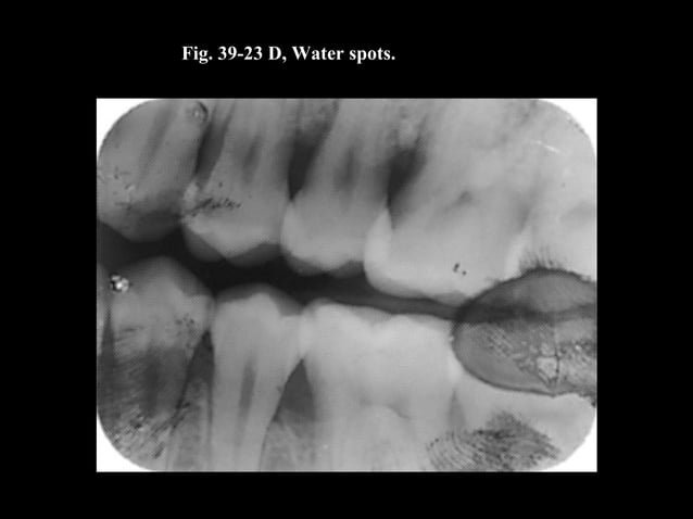 Lecture 7 dental x ray film, processing and processing errors lecture 7 ...