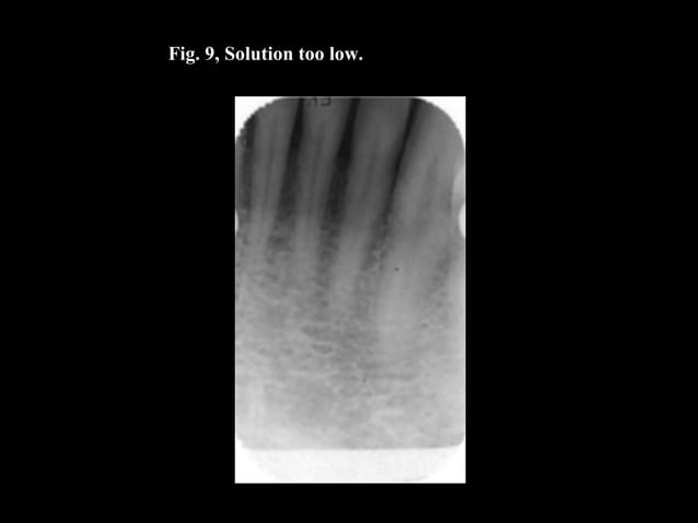 Lecture 7 dental x ray film, processing and processing errors lecture 7 ...