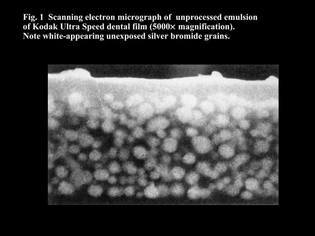 Lecture 7 dental x ray film, processing and processing errors lecture 7 ...