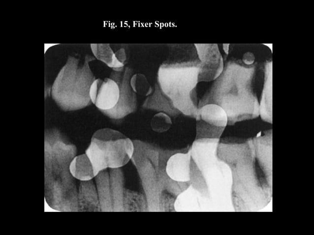 Lecture 7 dental x ray film, processing and processing errors lecture 7 ...
