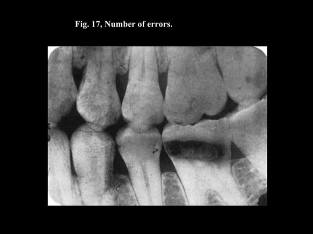 Lecture 7 dental x ray film, processing and processing errors lecture 7 ...