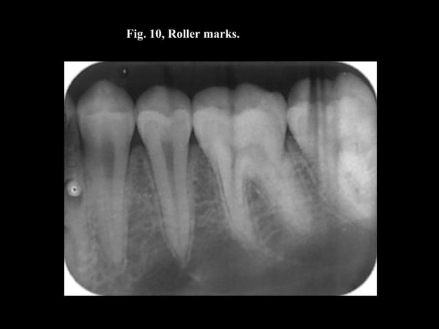 Lecture 7 dental x ray film, processing and processing errors lecture 7
