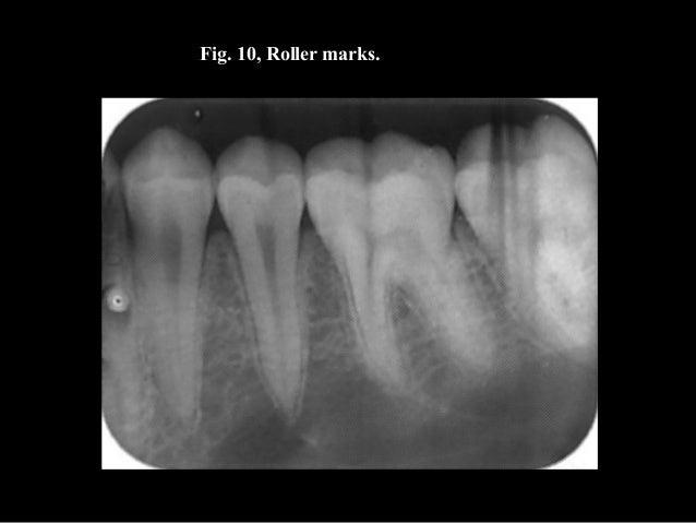 Lecture 7 dental x ray film, processing and processing errors lecture…