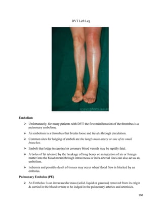 Lecture 7 diseases of the vascular system - Pathology | PDF