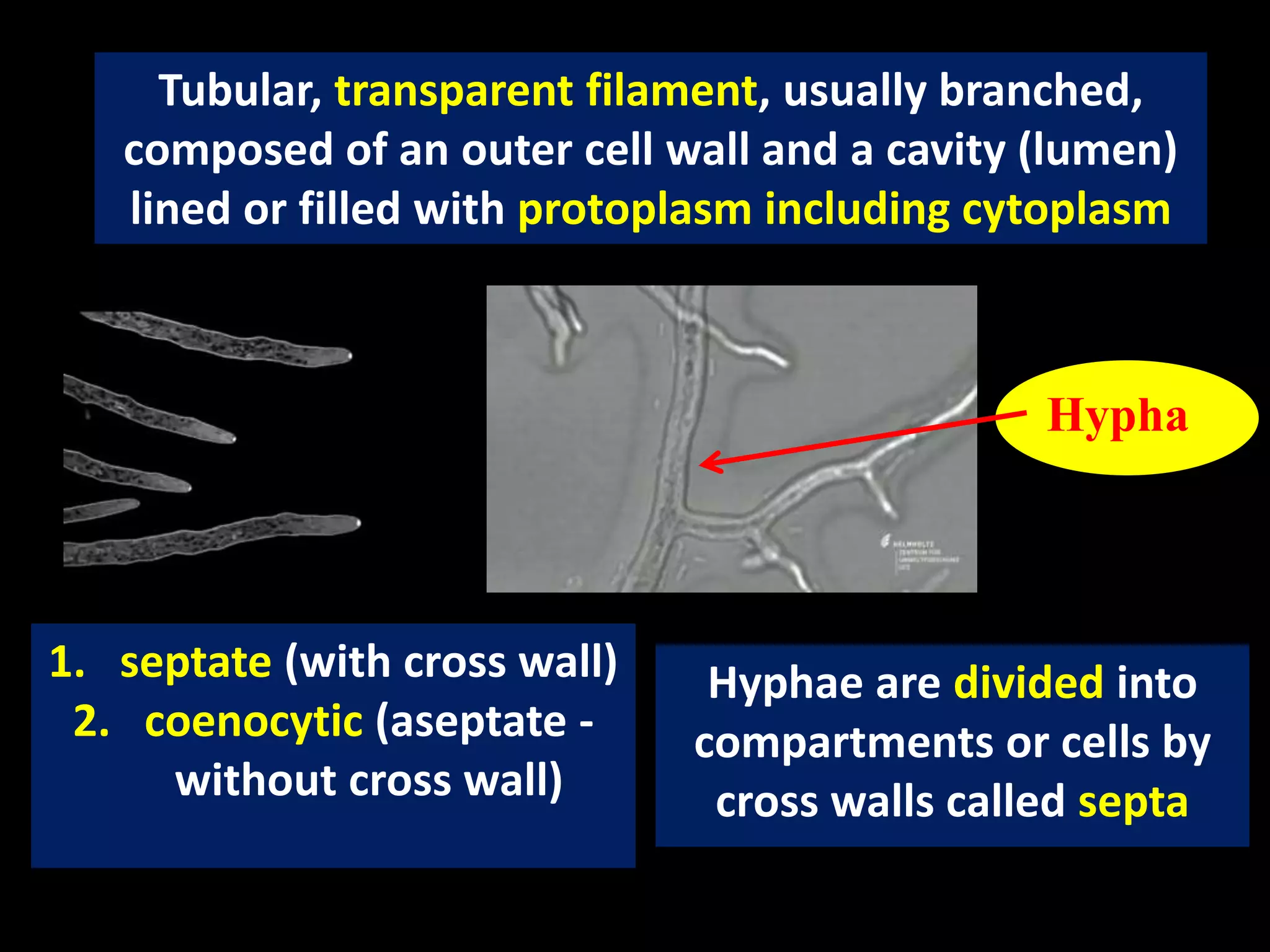 Lecture 7 General Characters of fungi - Vegetative structures.pptx
