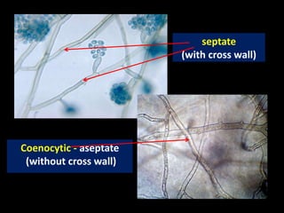 Lecture 7 General Characters of fungi - Vegetative structures.pptx