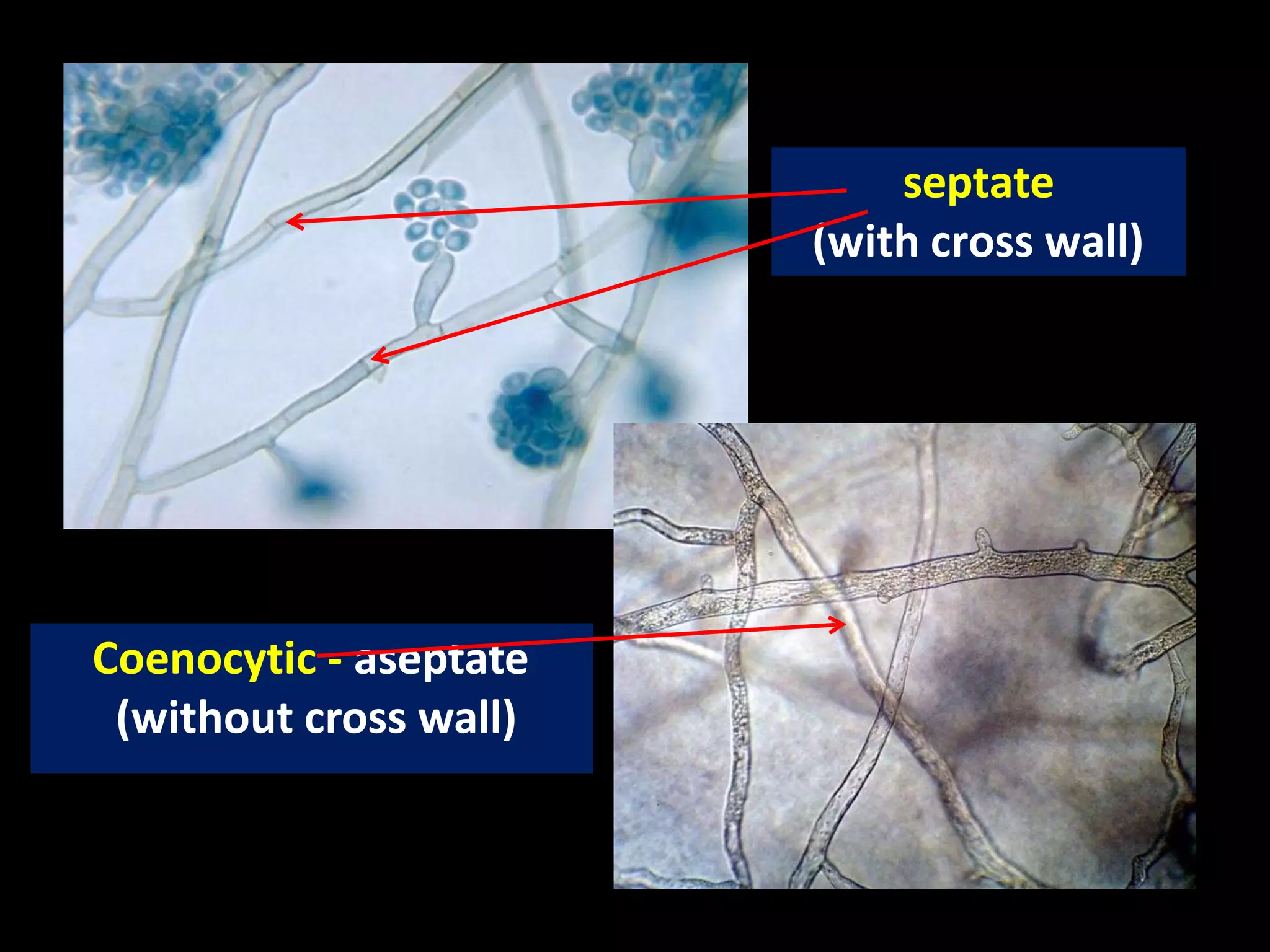 Lecture 7 General Characters of fungi - Vegetative structures (1).pptx