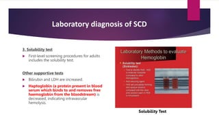 Lecture 7 (SCD New) 2.pptx | Blood Disorders | Diseases and Conditions