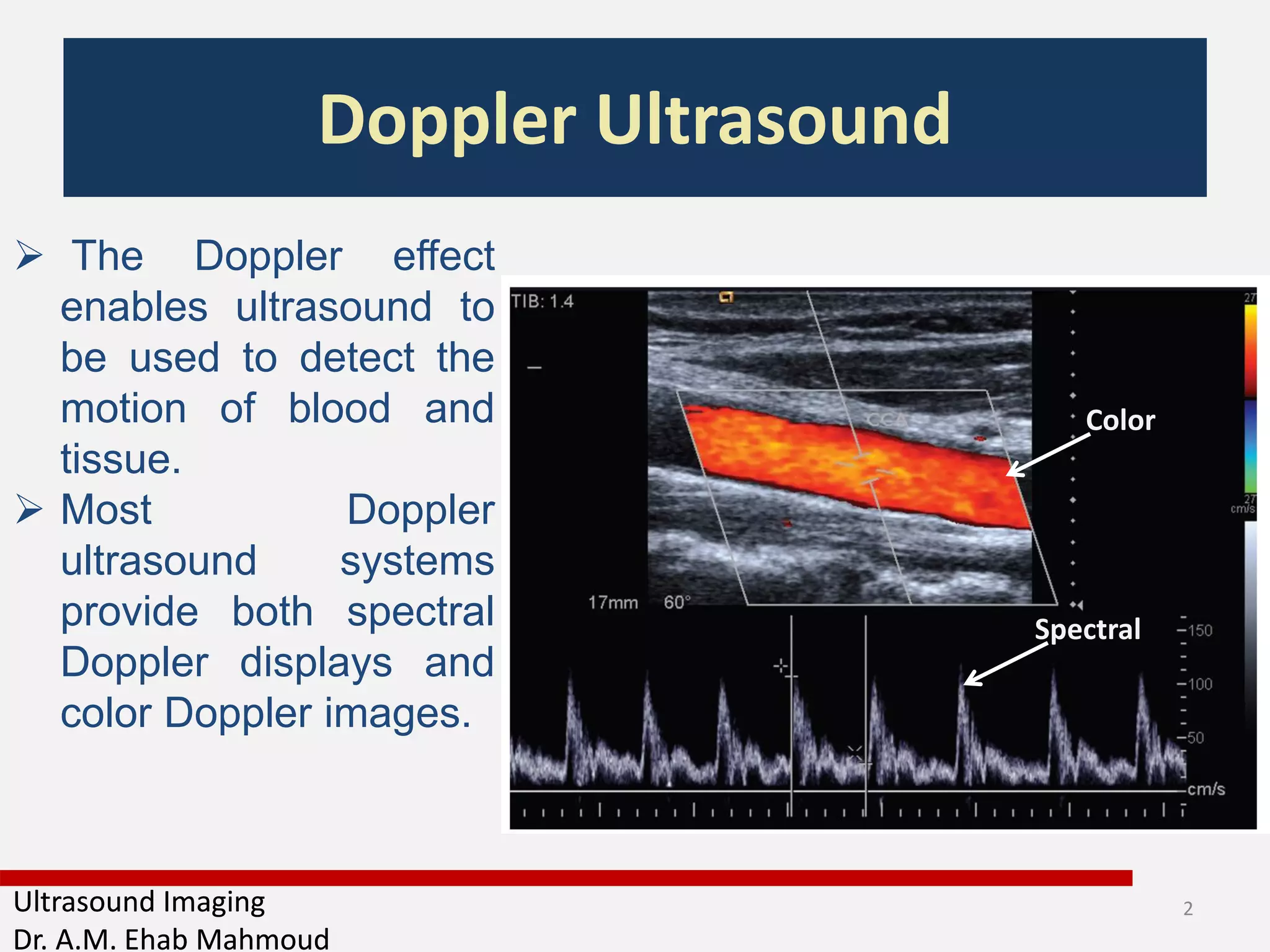 Medical Equipment Ultrasound Lecture 8 | PDF | Medical Tests | Medical ...