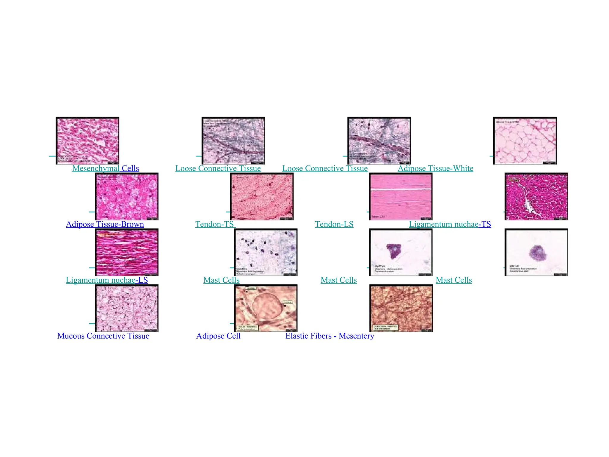 connective tissue by Dr. sadakat bashir.ppt
