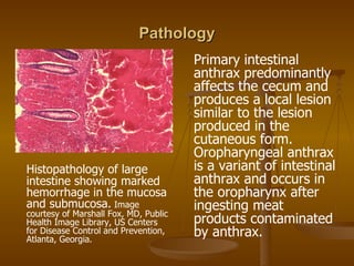 Lecture 8. anthrex, plague | PPT