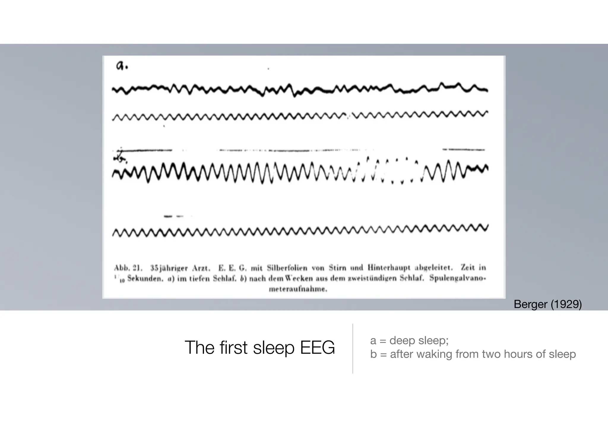 IVE 2024 Short Course - Lecture 8 - Electroencephalography (EEG) Basics | PPT