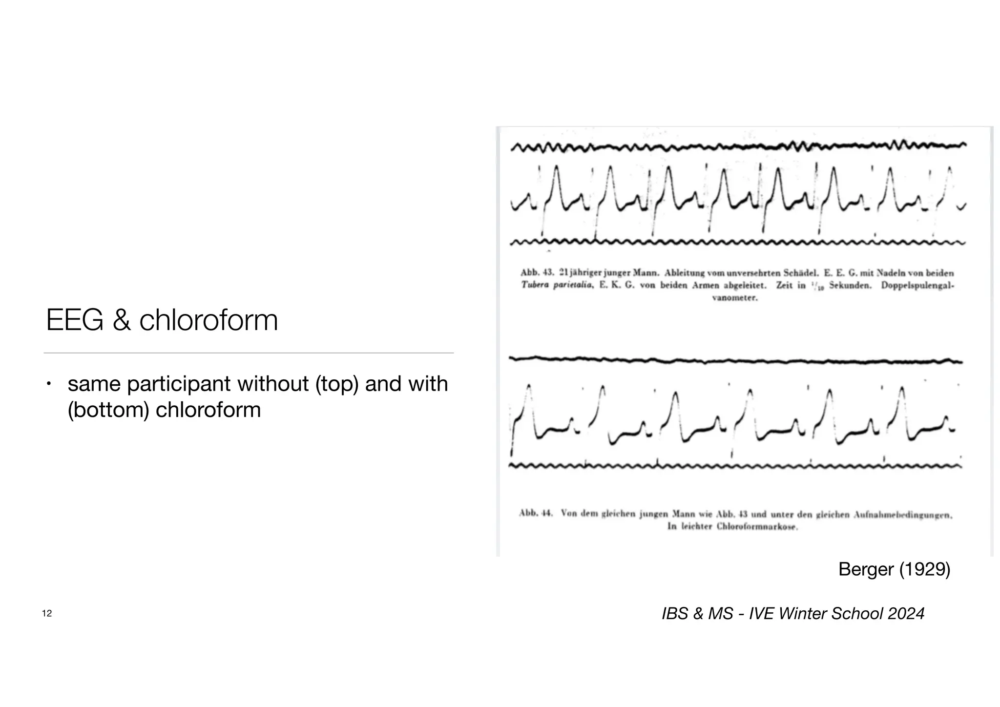 IVE 2024 Short Course - Lecture 8 - Electroencephalography (EEG) Basics ...