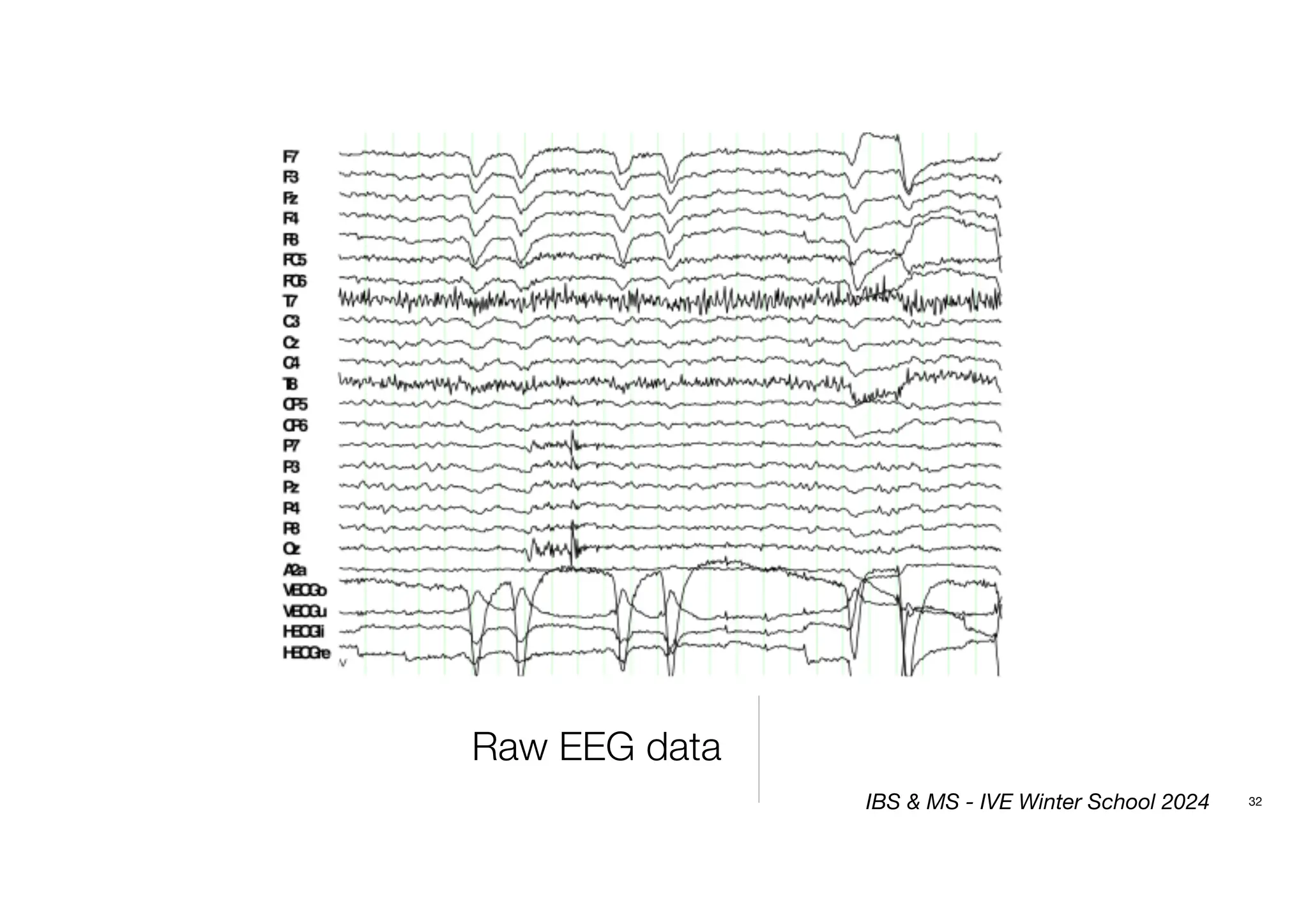 IVE 2024 Short Course - Lecture 8 - Electroencephalography (EEG) Basics ...