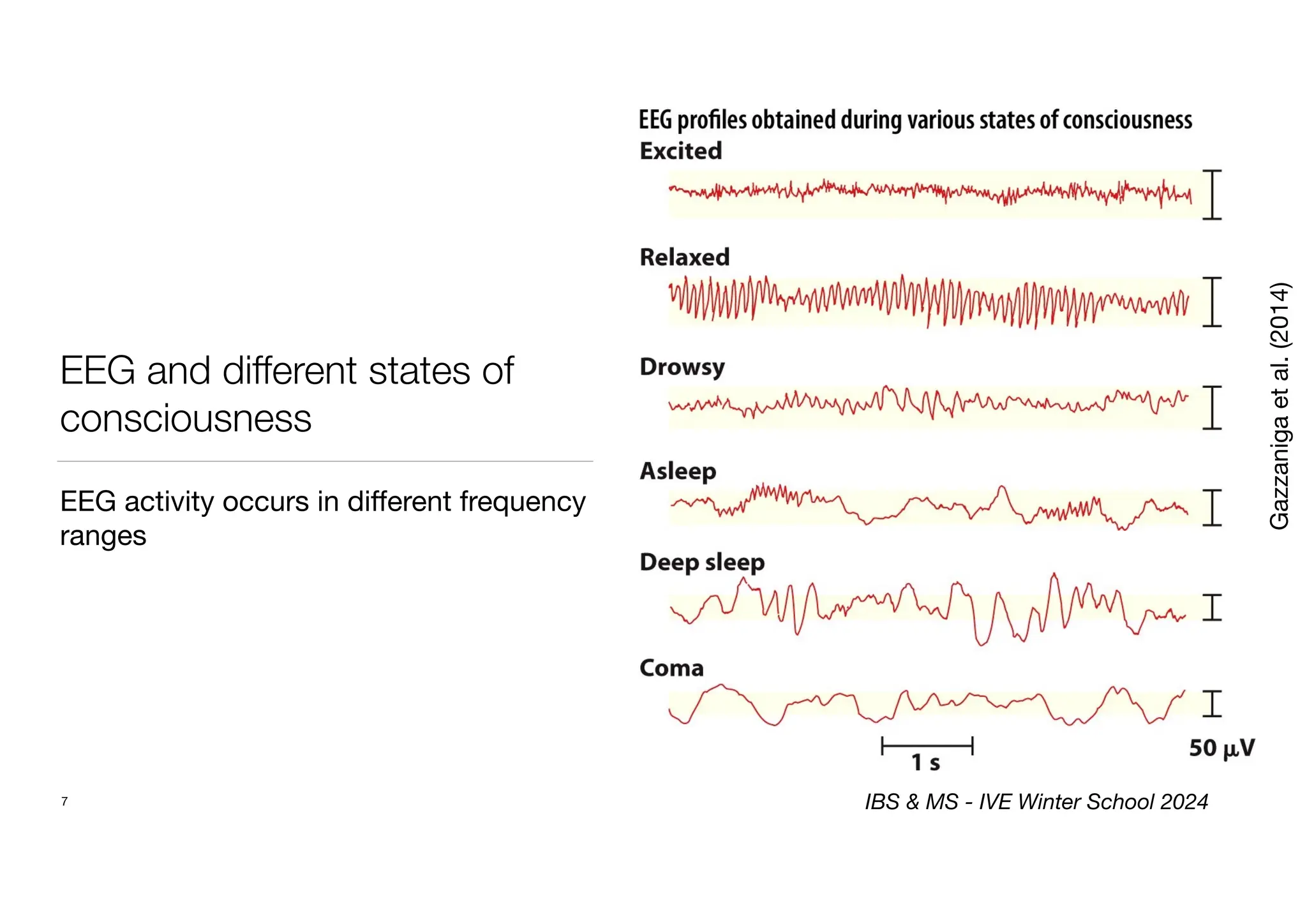 IVE 2024 Short Course - Lecture 8 - Electroencephalography (EEG) Basics | PPT