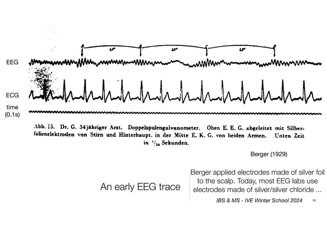 IVE 2024 Short Course - Lecture 8 - Electroencephalography (EEG) Basics ...