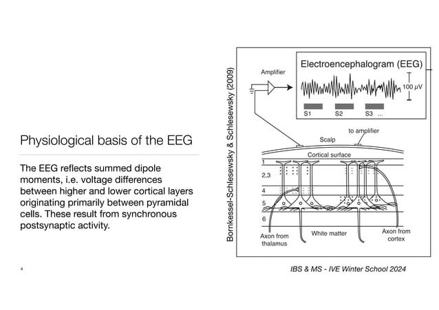 Ive 2024 Short Course Lecture 8 Electroencephalography Eeg Basics Ppt 