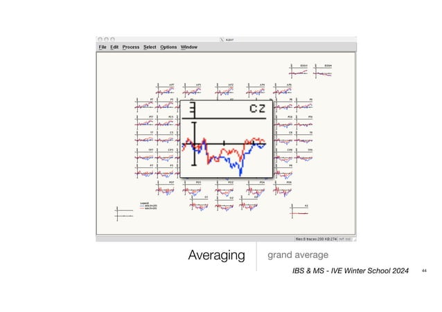 IVE 2024 Short Course - Lecture 8 - Electroencephalography (EEG) Basics ...