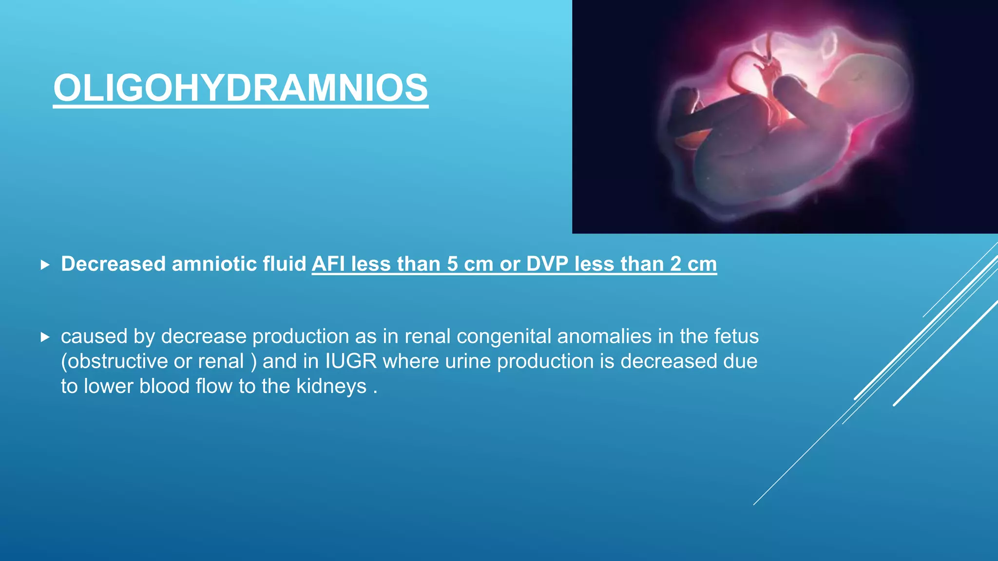 Lecture 8 Amniotic fluid disorders | PPT