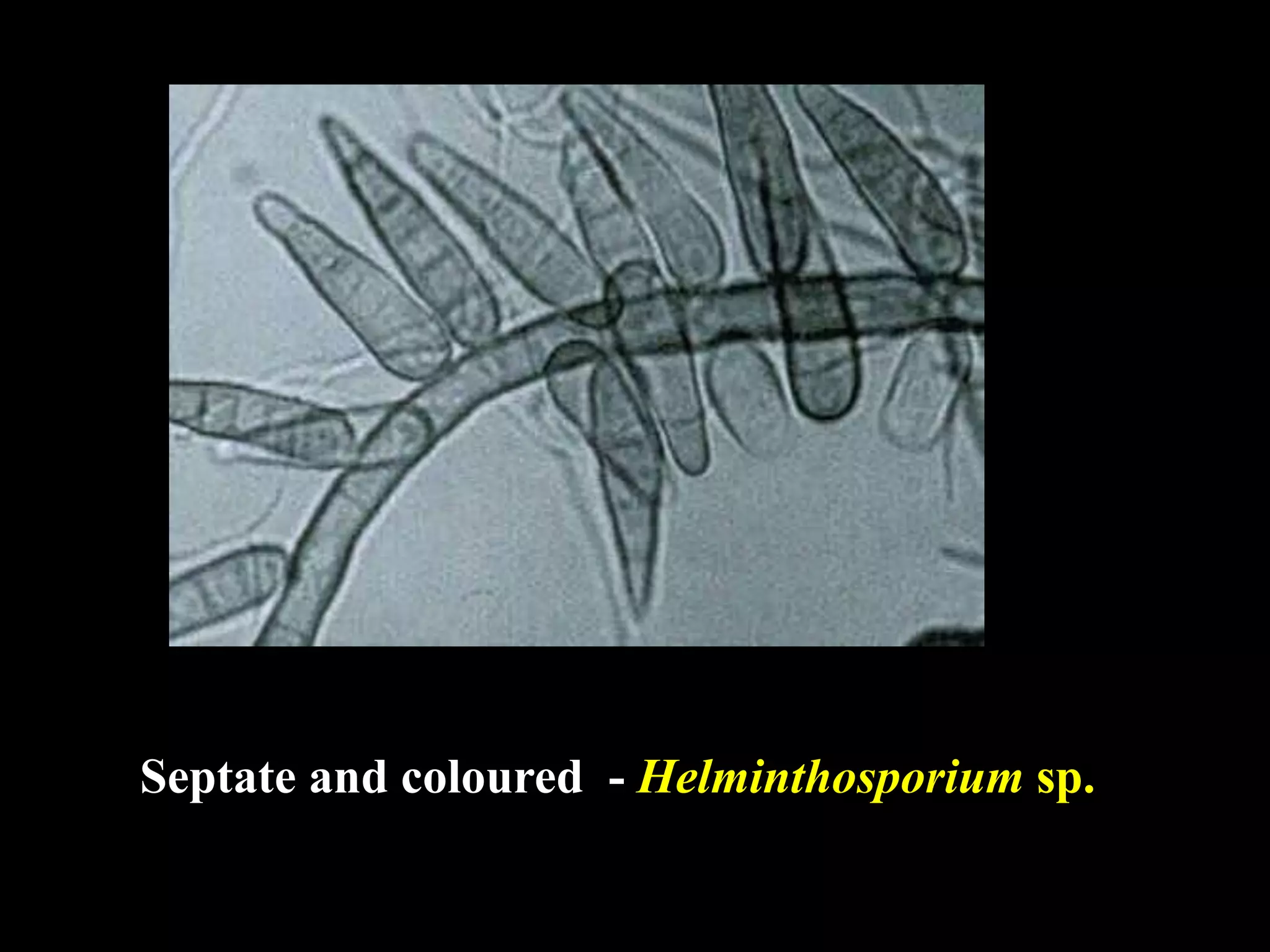 Lecture 8 Asexual Reproduction In Fungi Pptx