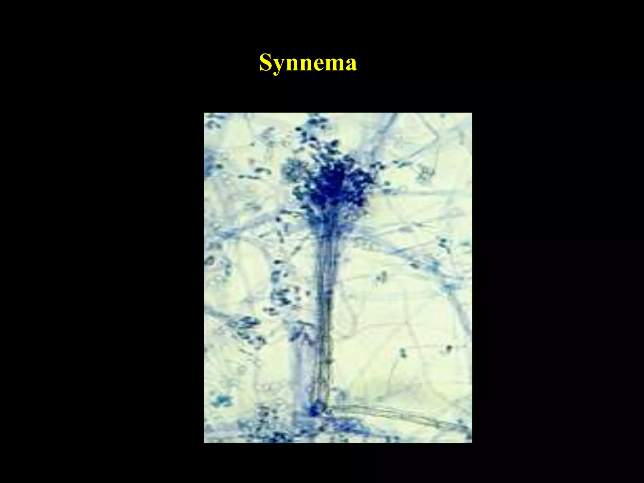 Lecture 8 Asexual reproduction in fungi.pptx