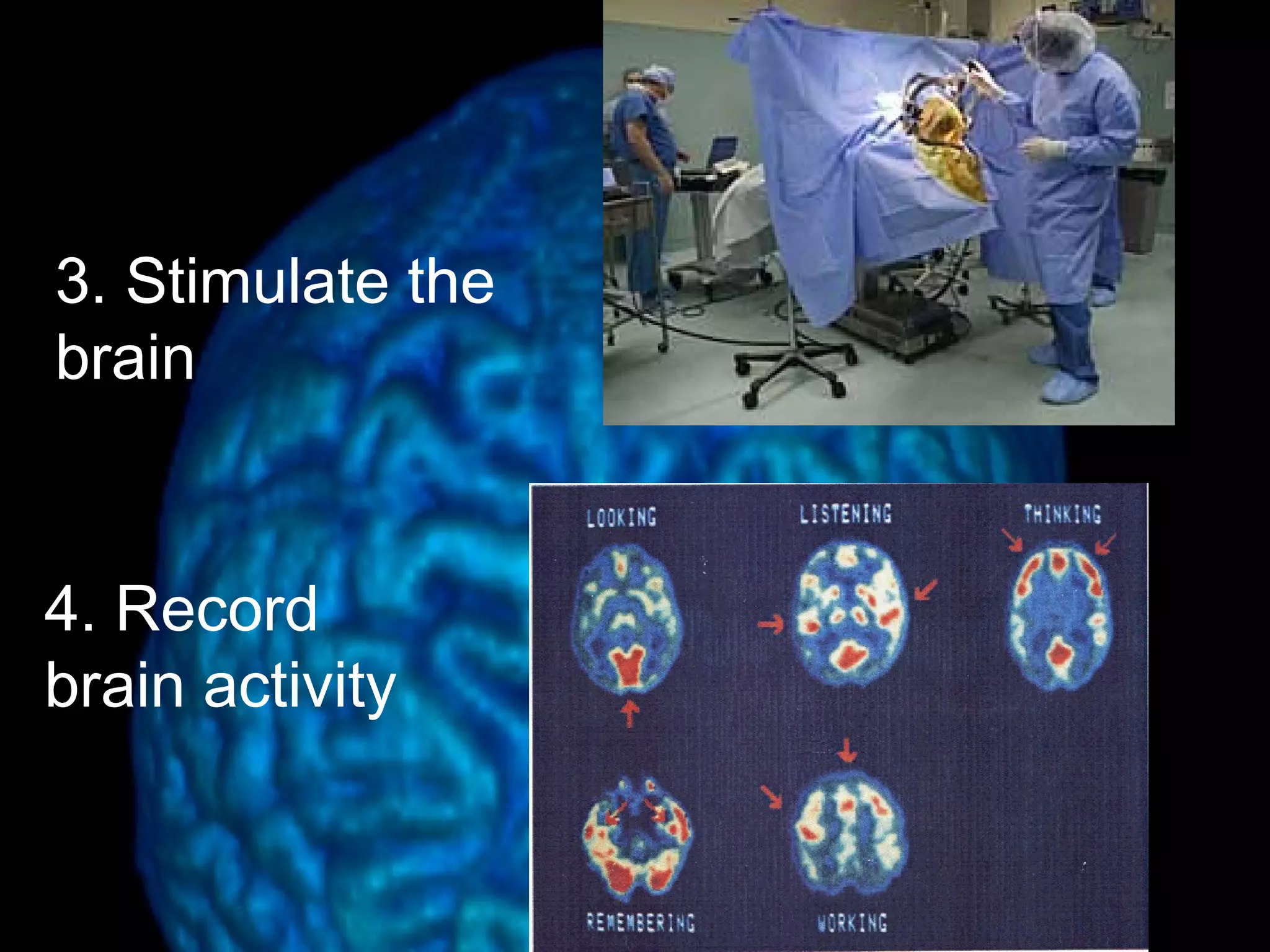 Lecture 8 brain structure | PPT | Brain and Nervous System Disorders ...