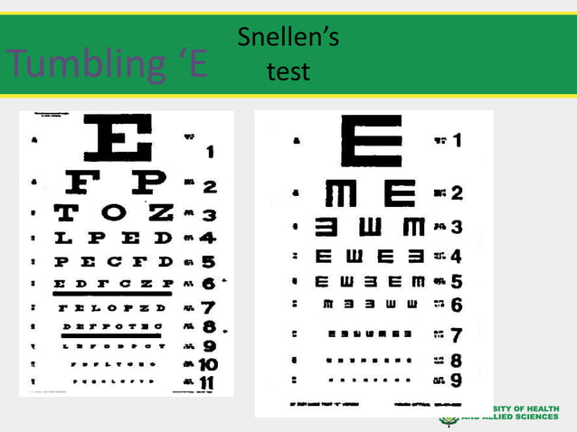 LECTURE 8 Eye Assessment.pdf Assessing the eye | PDF