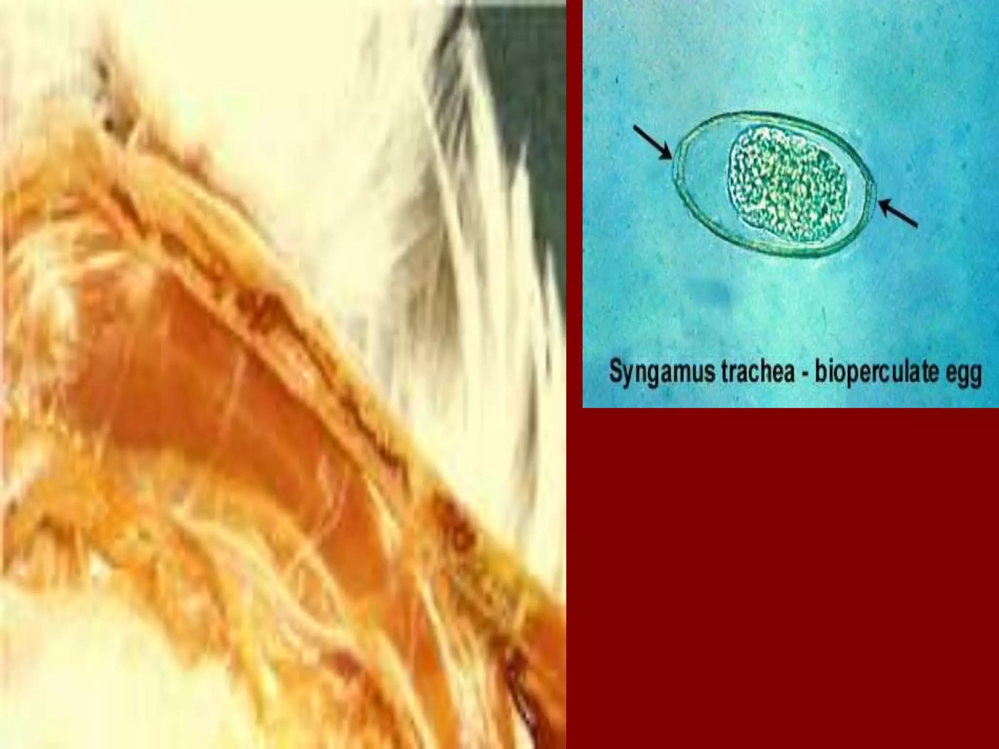 Lecture 8 syngamus, hook worms | PPT