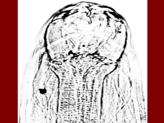 Lecture 8 syngamus, hook worms | PPT