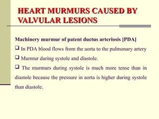 Lecture 9 - Heart sounds Lecture (2012).ppt