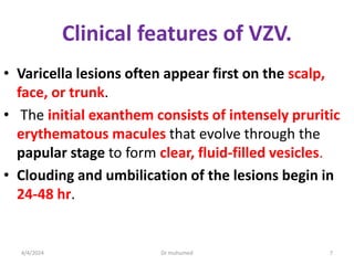 Lecture 9 Paediatric viral infections 1.-1.pptx