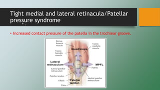 Lecture 9 Patellofemoral Dysfunction.pdf