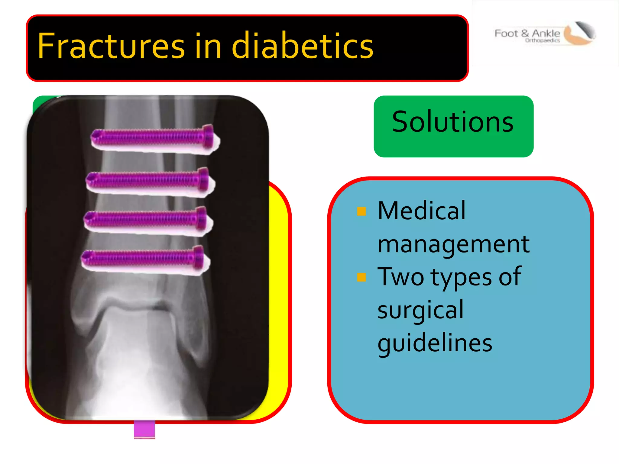 Lecture 9 shah ankle fractures | PPTX
