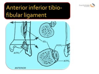 Lecture 9 shah ankle fractures | PPTX