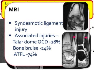 Lecture 9 shah ankle fractures | PPTX