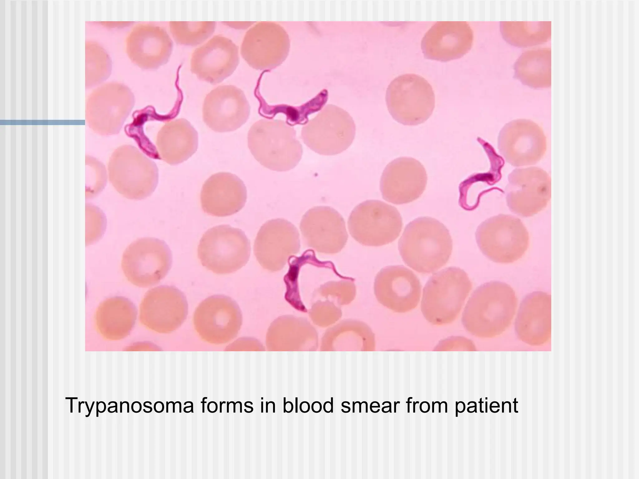 Lecture 9 (Trypanosoma) parasitology slides | PPT