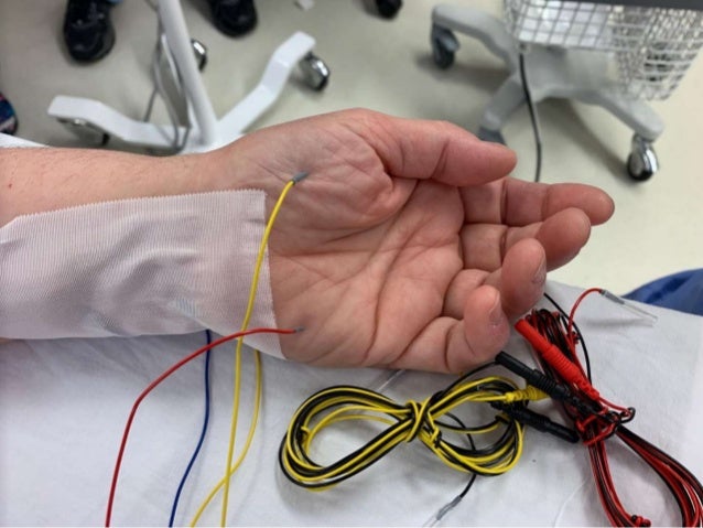 Spine Lecture Intraoperative neuromonitoring changes June 2019