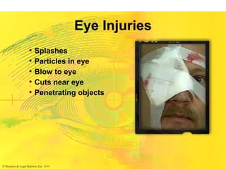 Lecture basic first aid - 1 | PPT