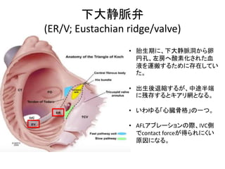 How to puncture the atrial septum (lectures for residents)