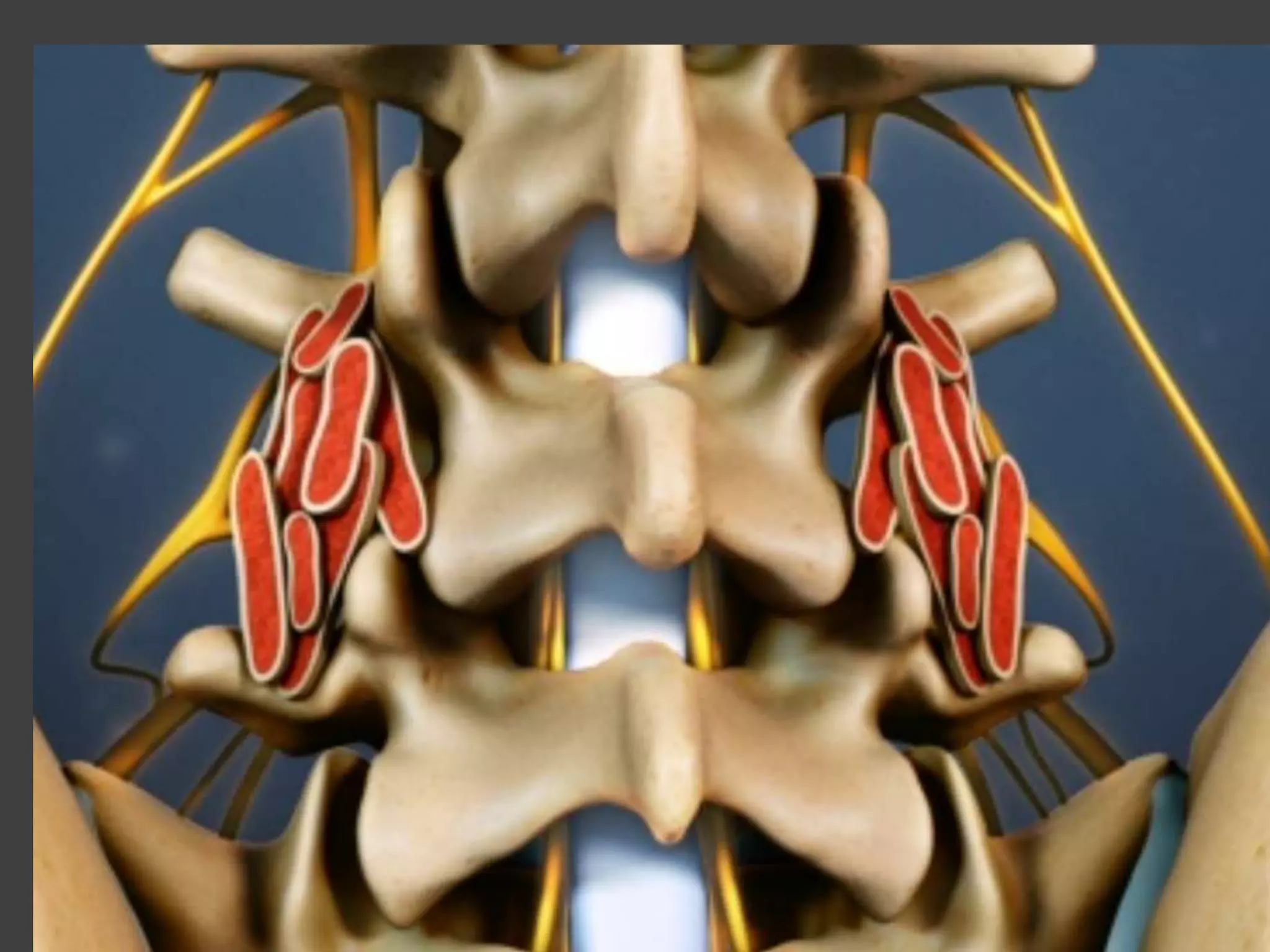 BMP bone morphogenic protein in spinal surgery | PPT | Free Download