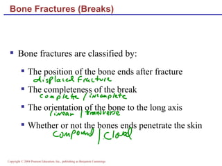 Lecture bone structure & markings #2clas | PPT