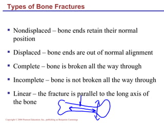 Lecture bone structure & markings #2clas | PPT