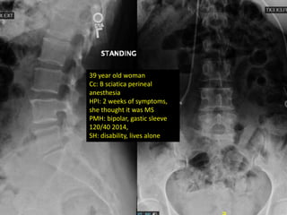 Cauda Equina syndrome | PPT